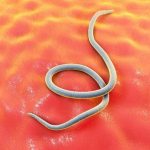 Threadworms | NIAS